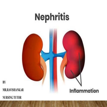 Nephritis.pptx
