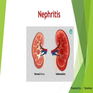 Nephritis slide share ,ppt.pptx definition , types , sign symptom ...