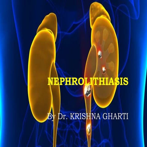 Nephrolithiasis | PPTX