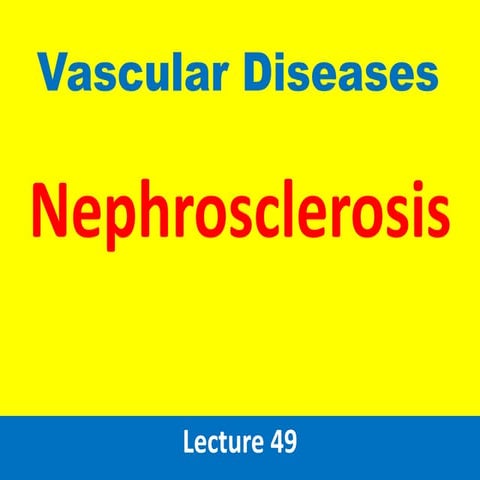 Nephrosclerosis | PPTX