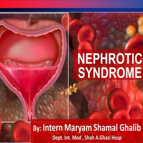 Nephrotic syndrome | PDF