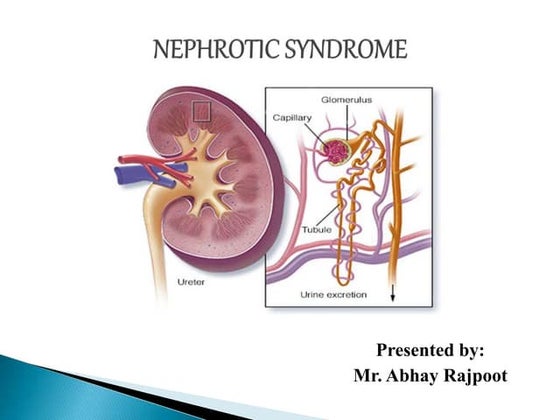 NEPHRITIS | PPT
