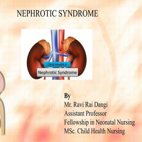 Nephrotic syndrome | PDF