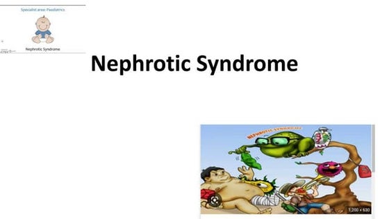 Nephrotic syndrome | PPTX | Medical Health