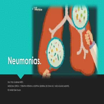 neumonía y su fisiopatología, mecanismos .pptx