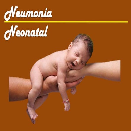 Termorregulación Neonatal | PPTX