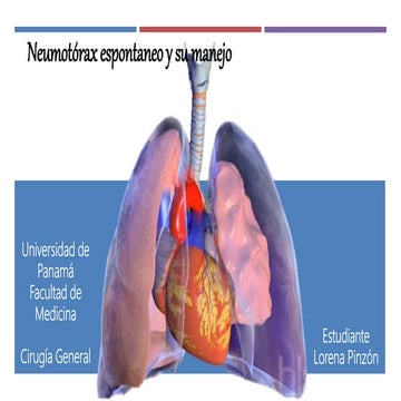 Neumotorax espontaneo | PPT
