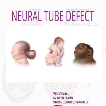 NEURAL TUBE DEFECT pptx | PPTX