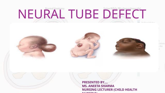 Neural tube defects | PPTX