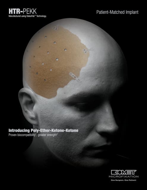 Neuro Lorenz Plating System | PDF