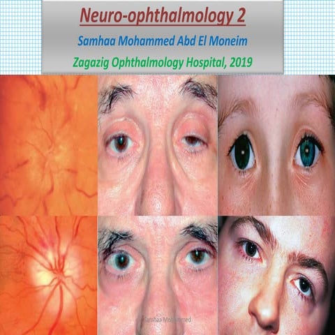 Neuro oph. 2 | PPTX