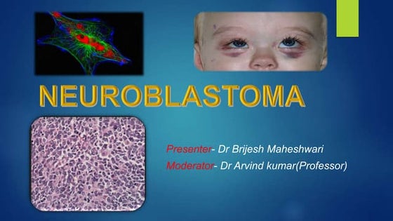 NEUROBLATOMA.pptx for education and research | PPT