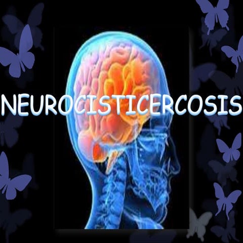 JOSE GONZALEZ CHUQUIZUTA - neurocisticercosis y toxoplasma.pdf