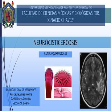 Neurocisticercosis. Neurología. CLinica Quirurgica III | PPTX