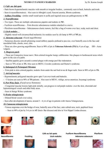 Harrison sulcus | PDF