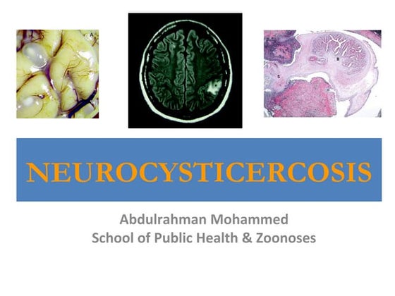 Taenia solium | PPTX | Digestive Disorders | Diseases and Conditions