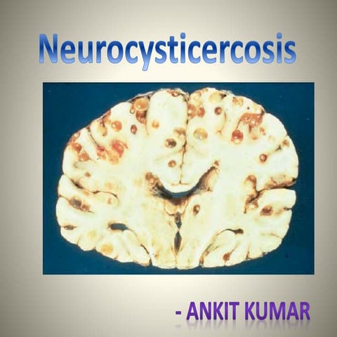 Neurocysticercosis | PPTX