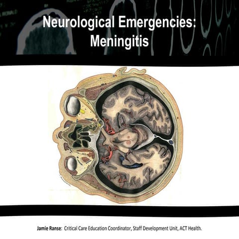 Neurological Emergencies | PPT