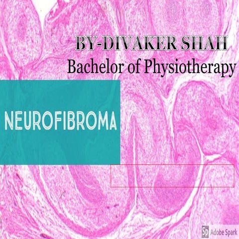 Neurofibroma | PPTX