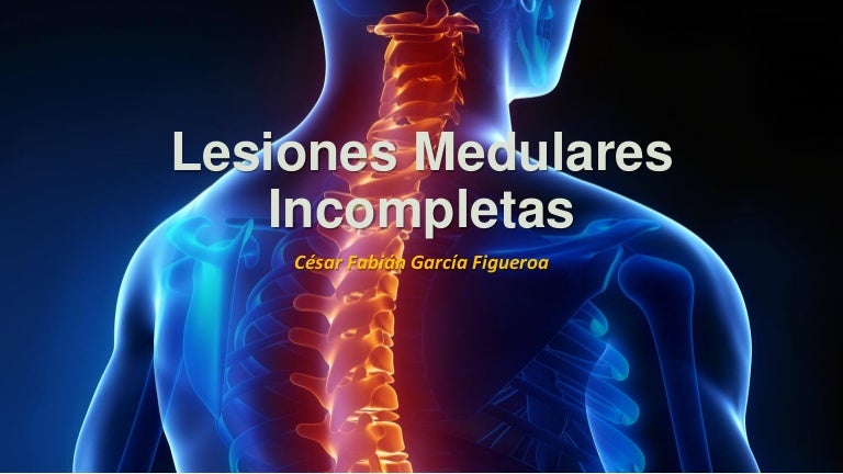 Lesiones Medulares