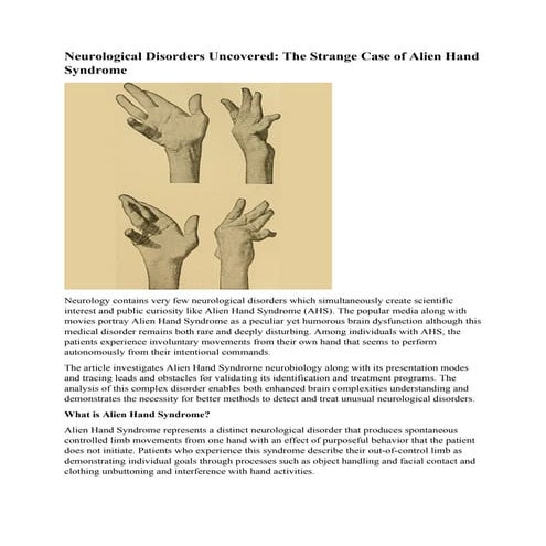 Neurological Disorders Uncovered: The Strange Case of Alien Hand ...