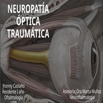Neuropatía óptica traumática (Nervio óptico, defecto pupilar aferente ...