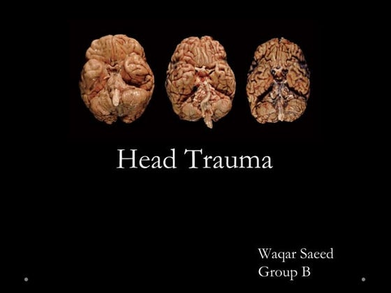 Head Injury.pptx