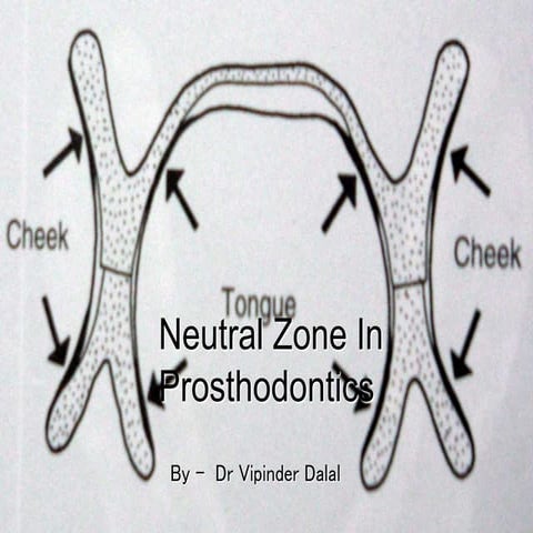 Neutral Zone In Prosthodontics part 1.ppt