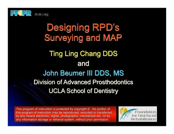 removable partial denture survey lines, path of insertion, guide planes ...