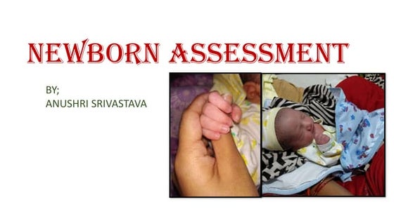 Newborn assessment | DOCX | Pregnancy | Reproductive Health