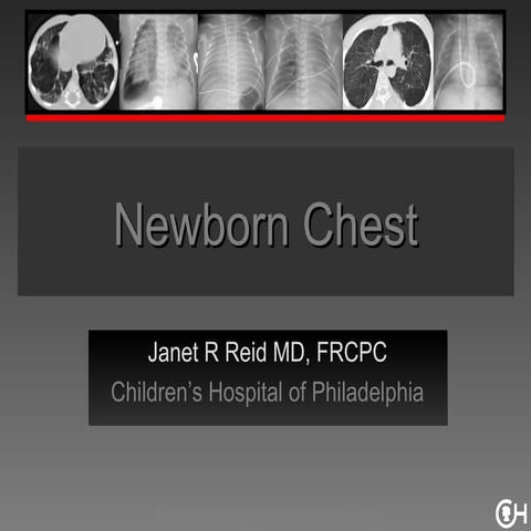 Neonatal Chest X-Ray | PPTX