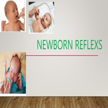 Newborn Reflex.pptx