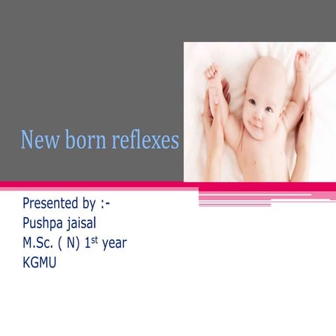 Newborn Reflexes PPT Neonatal Reflexes : PowerPoint Presentation,