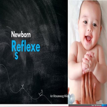 Newborn Reflexes PPT.pptx,,,,,,,,,,,,,,, | PPTX