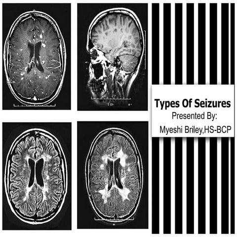 Types Of Seizures Myeshi Briley,HS-BCP | PPT
