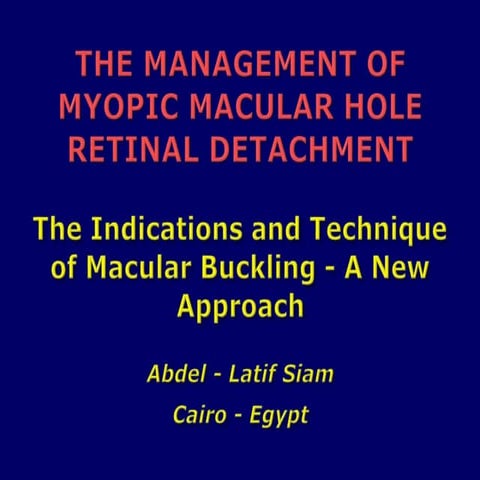 THE MANAGEMENT OF MYOPIC MACULAR HOLE RETINAL DETACHMENT | PPT