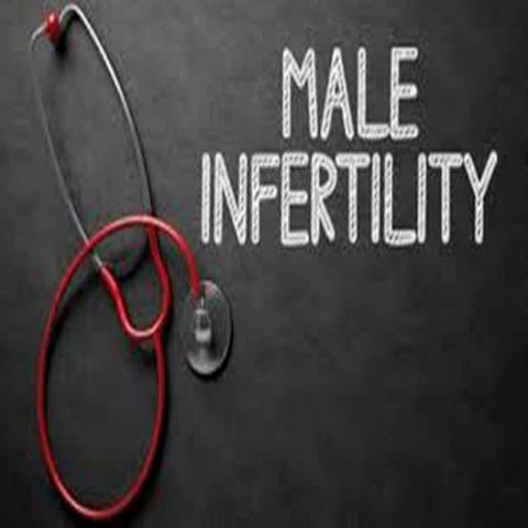 male infertility | PPTX