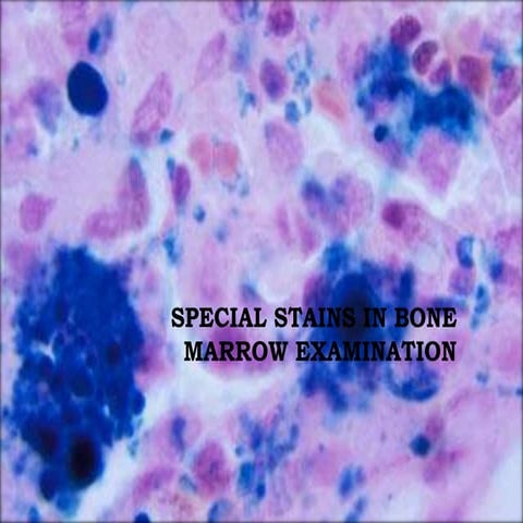 Special stains in Bone marrow examination | PPTX