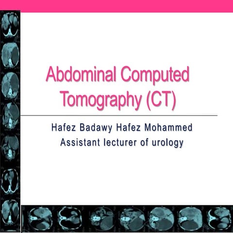 Ct urinary system in radiology | PPT