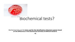 Biochemical test of bacteria | PPT