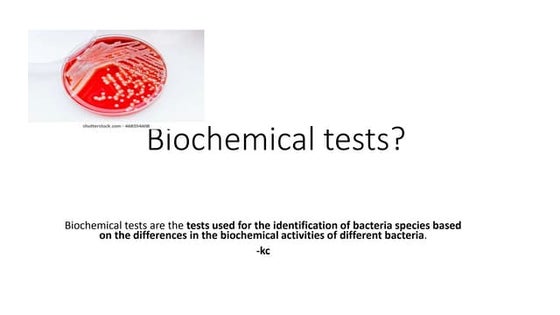 IMViC (Biochemical test) | PPT