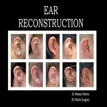 Auricular reconstruction.pptx