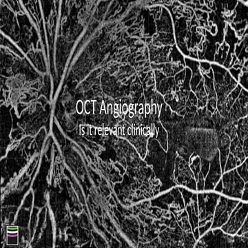 OCT angiography clinical relevance .pptx