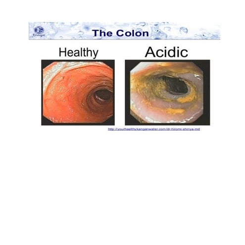 Dr. Hiromi Shinya endorses Kangen Water | RTF