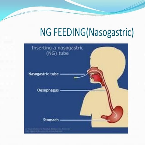NG FEEDING.pdf