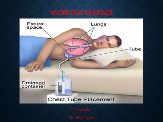 Nasogastric tube (NG tube) | PPTX | Ear, Nose and Throat Conditions | Diseases and Conditions