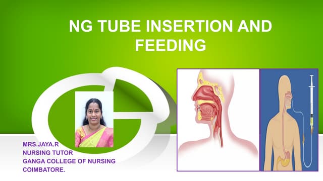 Tube feeding ( Gavage feeding ) | PPTX