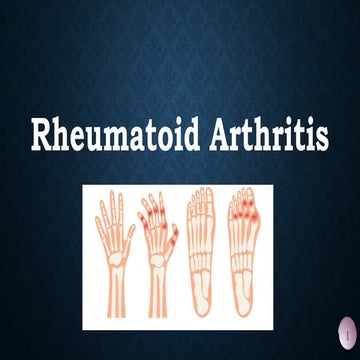 Rheumatoid Arthritis: Pathology, Etiology & Diagnosis (PPT & PDF) | PPTX