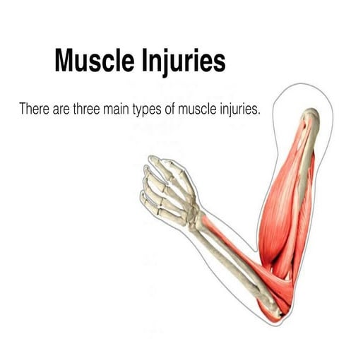 Muscle Injuries | PDF