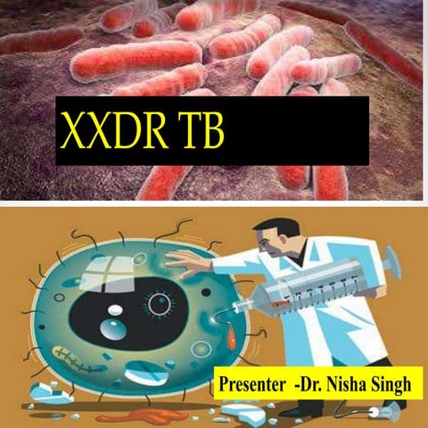 xxdr tb | PPT